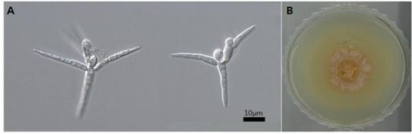 국립낙동강생물자원관, 희귀 담수균류 60종 발견